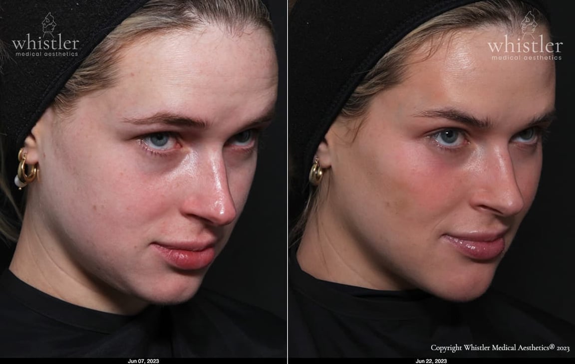 The Artistry Of MD Codes 7 Point Shape