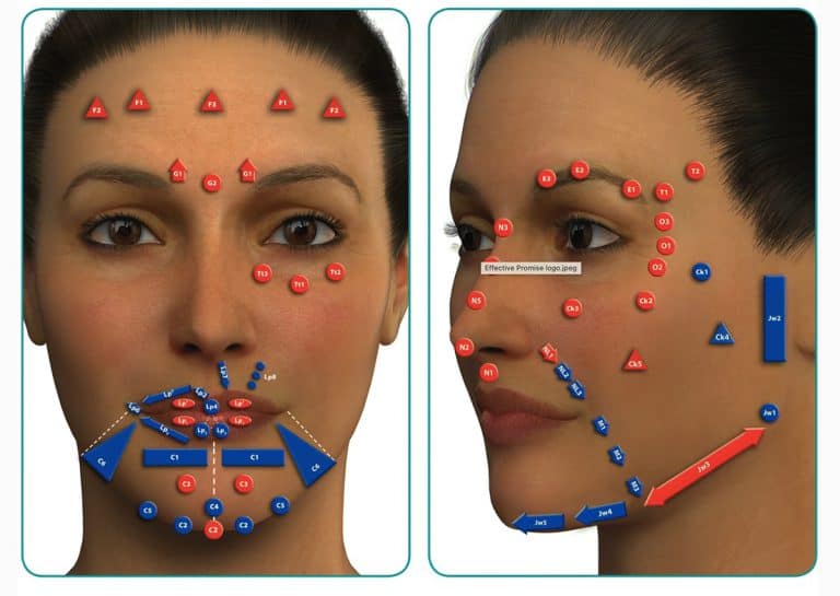 MD Codes™ Whistler Your Master Injector Dr. Sarah Kennea Dermal Fillers ...